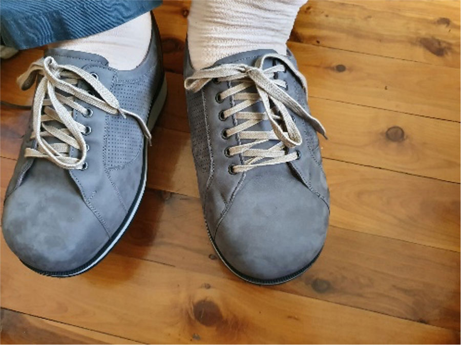 High Risk Diabetic Neuropathic Foot | THANNER Australia